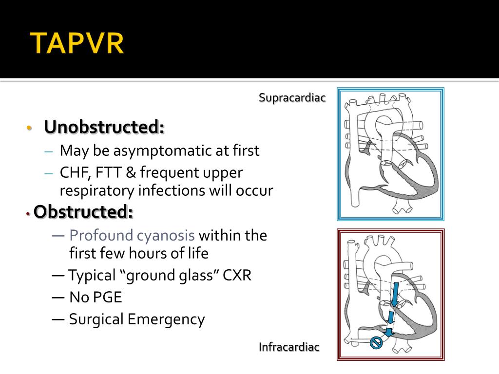 PPT - Cardiac Surgical Anomalies in the Neonate PowerPoint Presentation ...