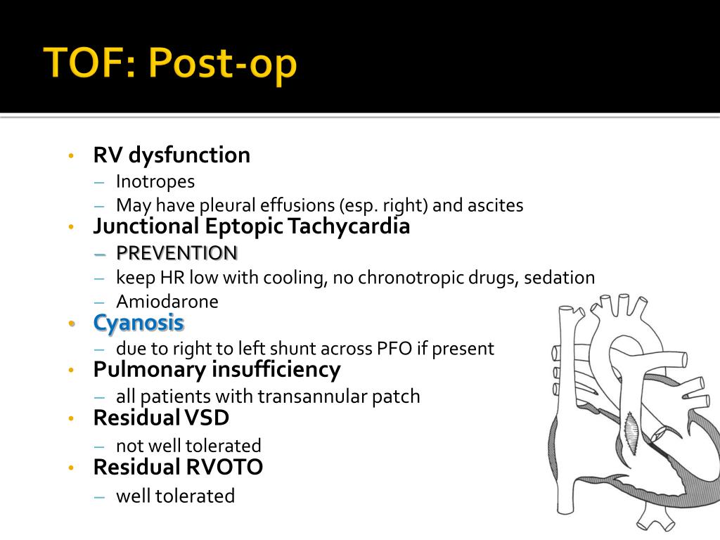 PPT - Cardiac Surgical Anomalies in the Neonate PowerPoint Presentation ...