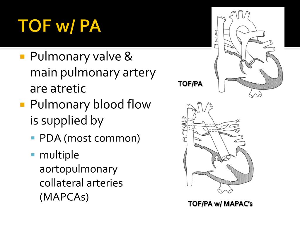 PPT - Cardiac Surgical Anomalies in the Neonate PowerPoint Presentation ...