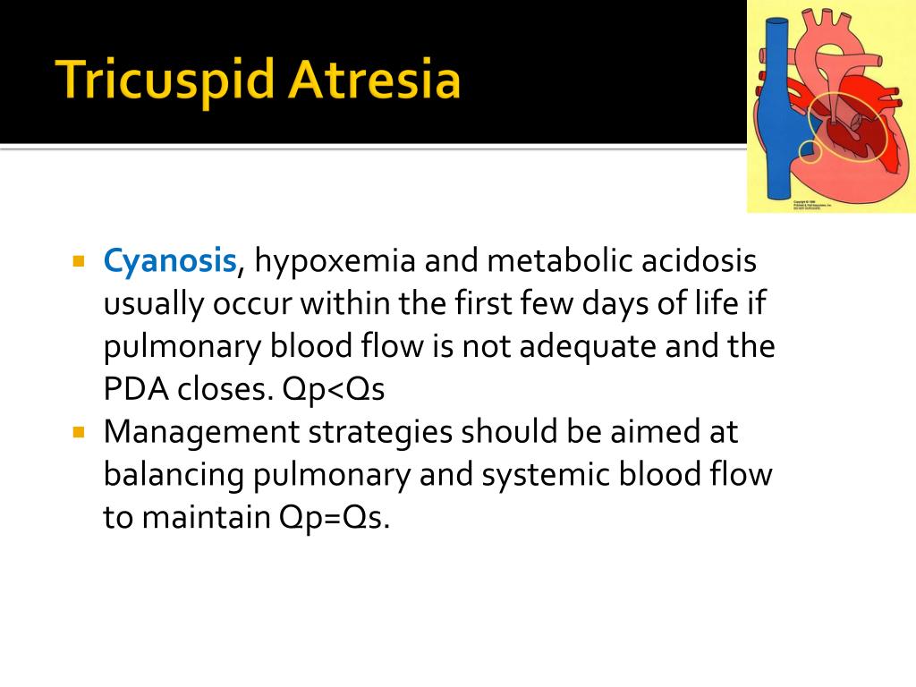 PPT - Cardiac Surgical Anomalies in the Neonate PowerPoint Presentation ...