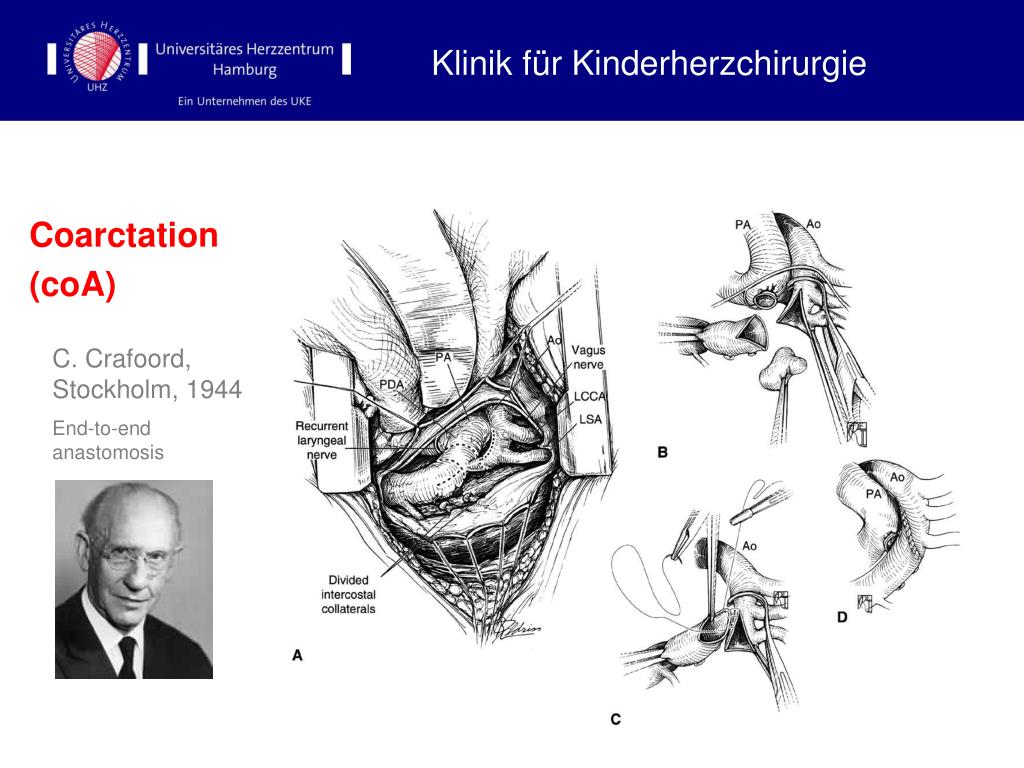 PPT - A. Dodge-Khatami, MD, PhD Chief of Pediatric Cardiac Surgery ...