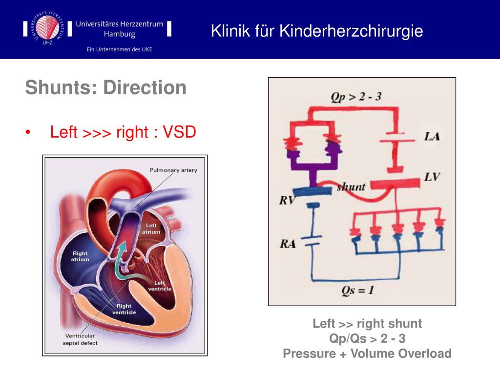 PPT - A. Dodge-Khatami, MD, PhD Chief of Pediatric Cardiac Surgery ...
