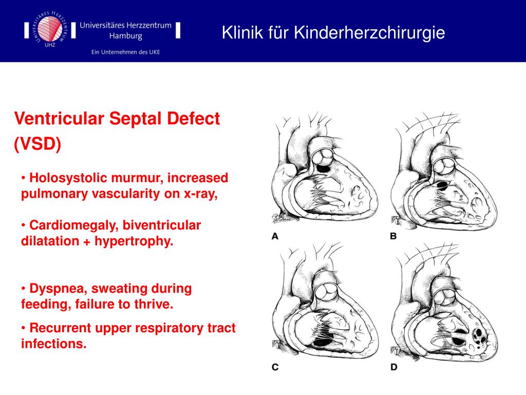 PPT - A. Dodge-Khatami, MD, PhD Chief of Pediatric Cardiac Surgery ...