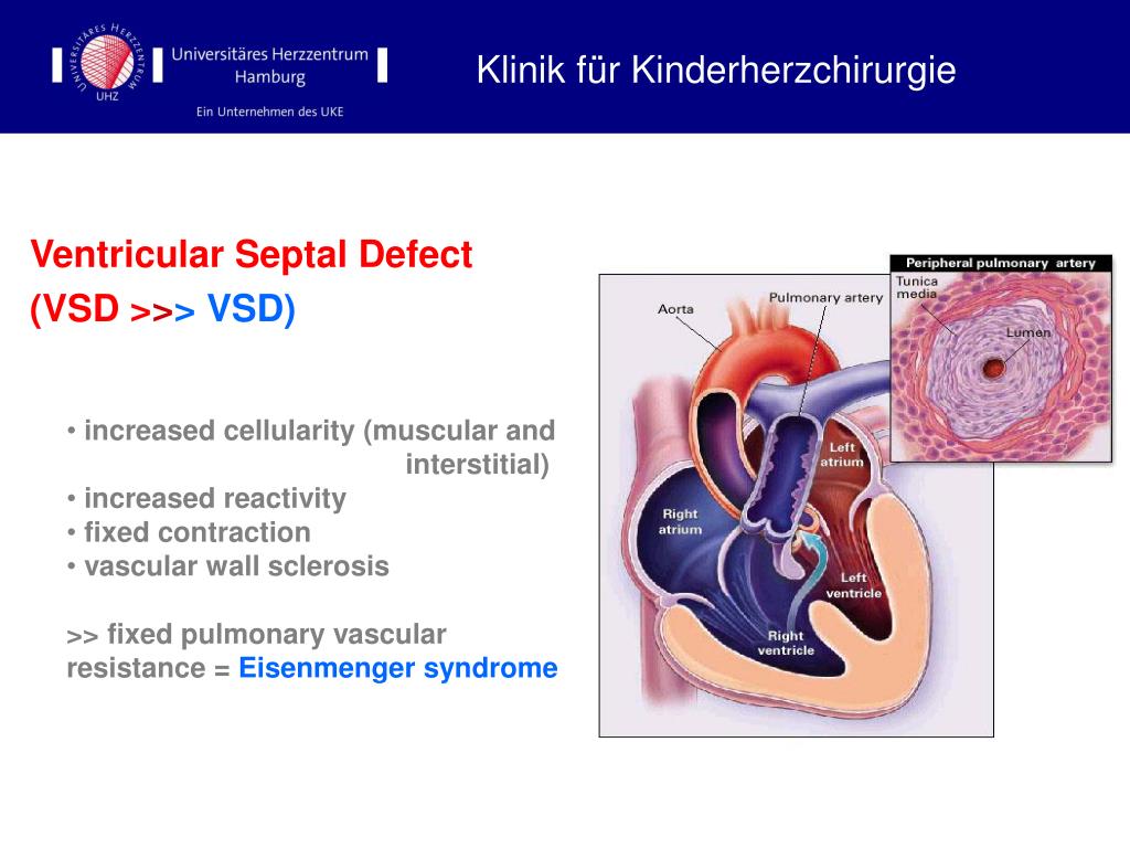 PPT - A. Dodge-Khatami, MD, PhD Chief of Pediatric Cardiac Surgery ...