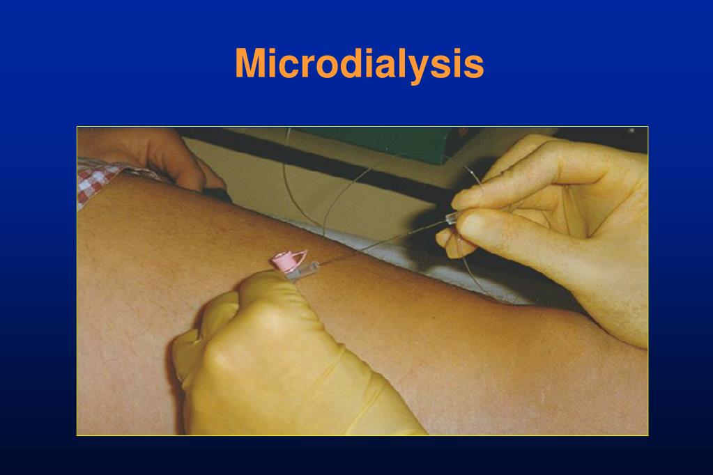 PPT - The General Concepts of Pharmacokinetics and Pharmacodynamics ...