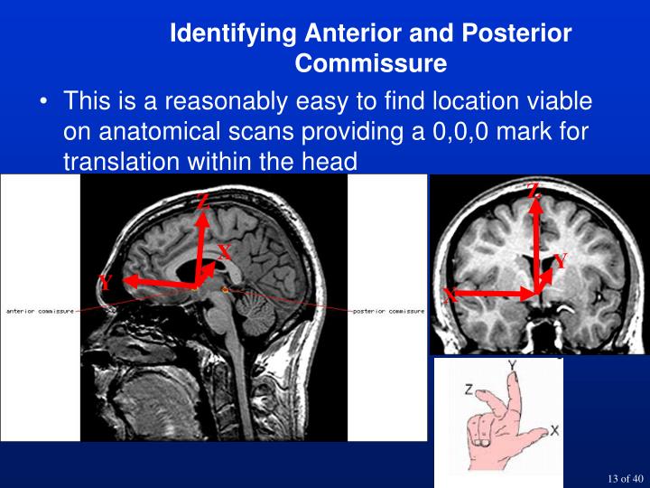 PPT - Lecture 4-Neuroanatomy Walter Schneider PowerPoint Presentation ...