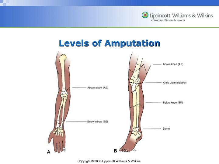 PPT - Chapter 69 Management of Patients With Musculoskeletal Trauma ...