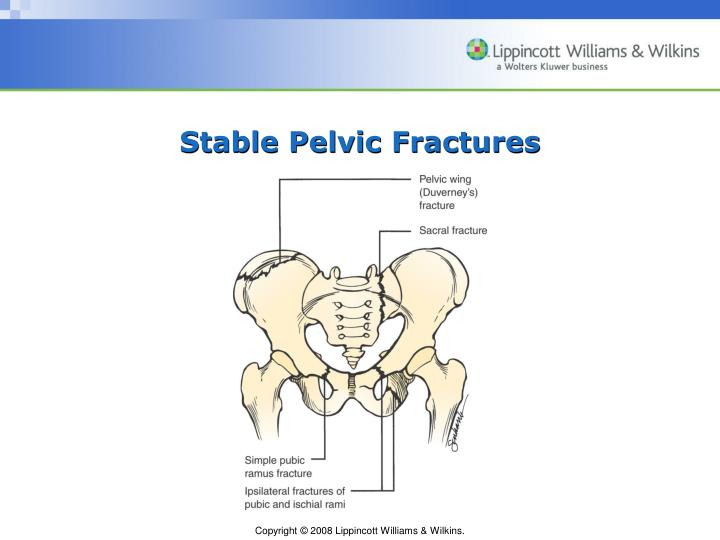 PPT - Chapter 69 Management of Patients With Musculoskeletal Trauma ...
