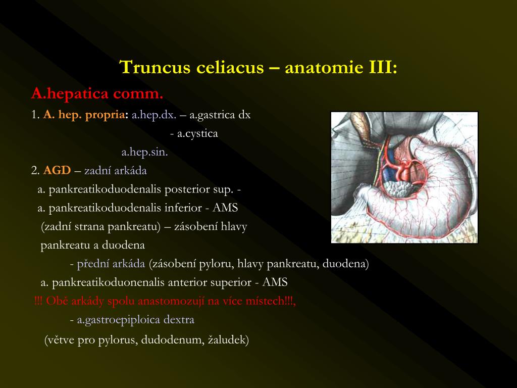 PPT - Nevariceální krvácení do GIT radiologická diagnostika a léčba ...
