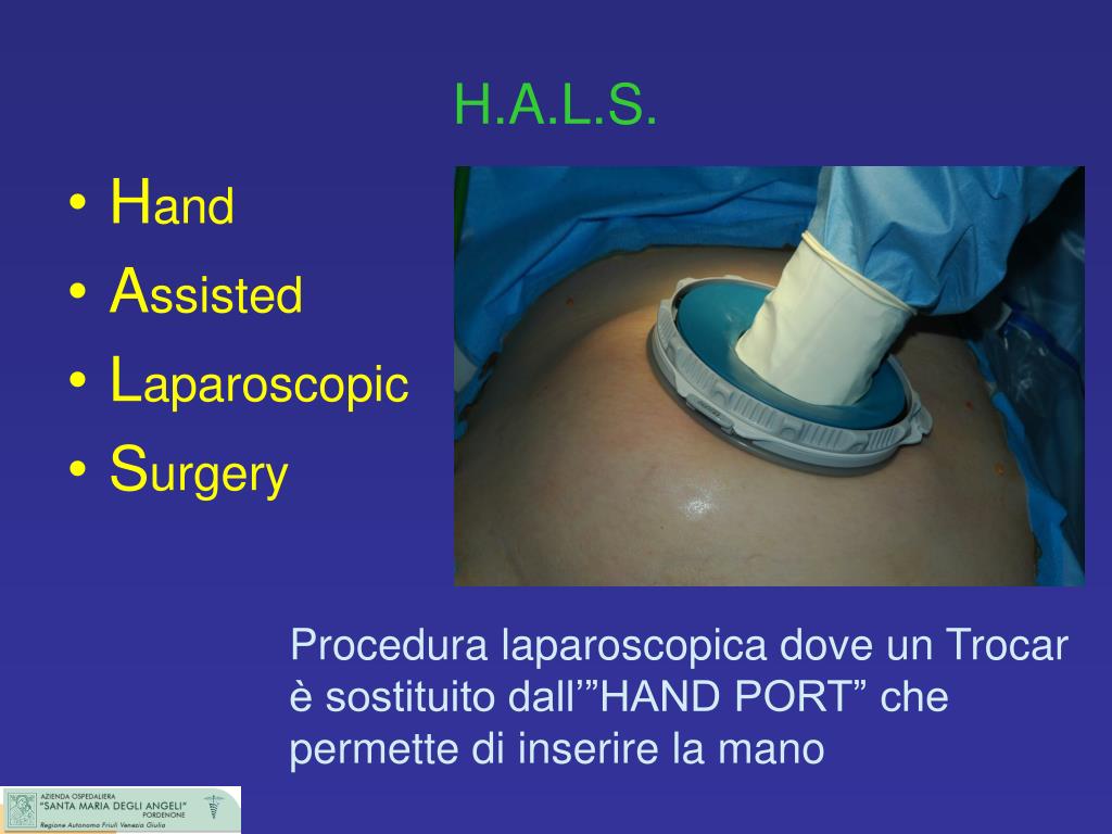 PPT - La chirurgia laparoscopica del colon-retto con approccio hand ...