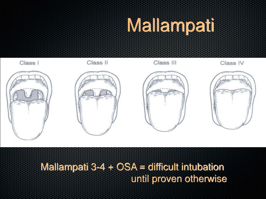PPT - Luc Sermeus Antwerp University Hospital Belgium PowerPoint ...