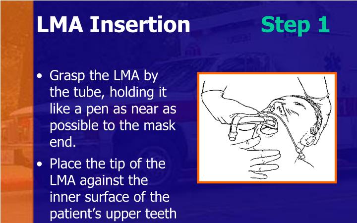 PPT - Laryngeal Mask Airways (LMA) Indications and Use for the Pre ...