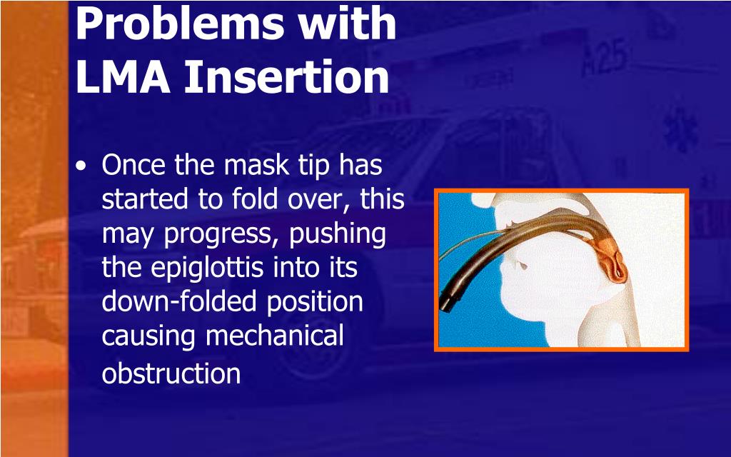 PPT - Laryngeal Mask Airways (LMA) Indications and Use for the Pre ...