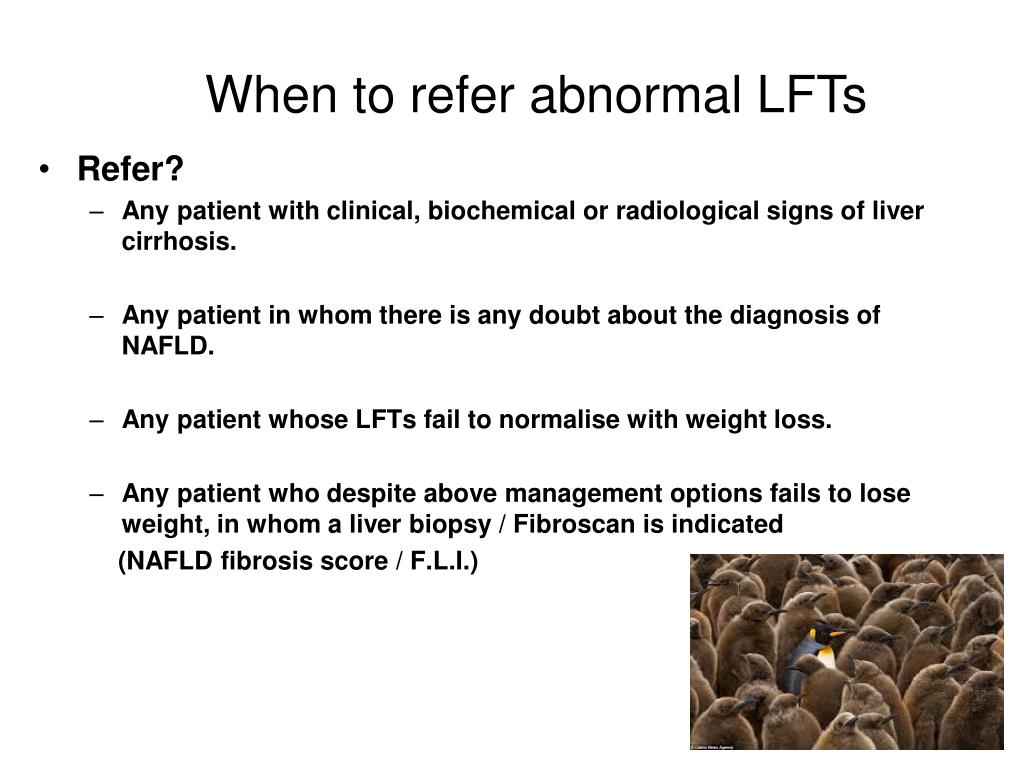 PPT - Non-alcoholic fatty liver disease and when to refer abnormal LFTs ...