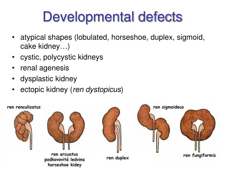 PPT - Urinary system Systema urinarium Kidneys Renes PowerPoint ...