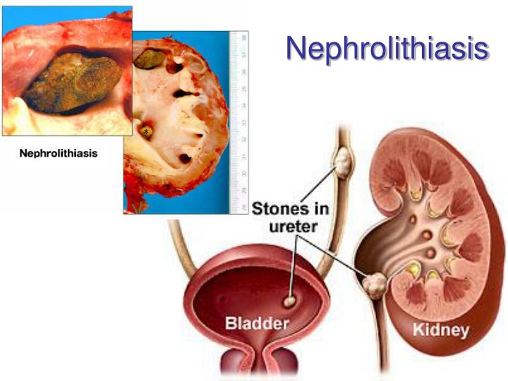 PPT - Urinary system Systema urinarium Kidneys Renes PowerPoint ...