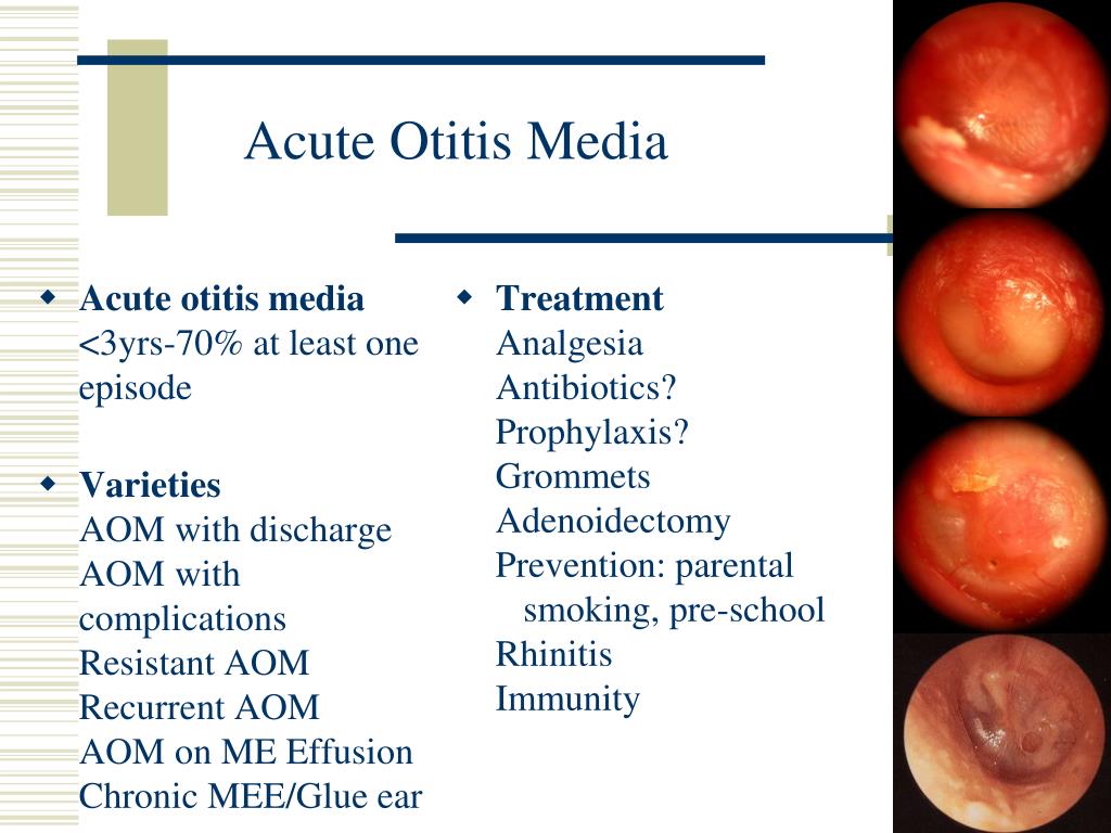 PPT - Blocked or painful ears Wax and otitis media PowerPoint ...