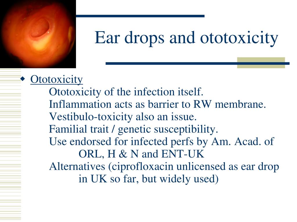 PPT - Blocked or painful ears Wax and otitis media PowerPoint ...