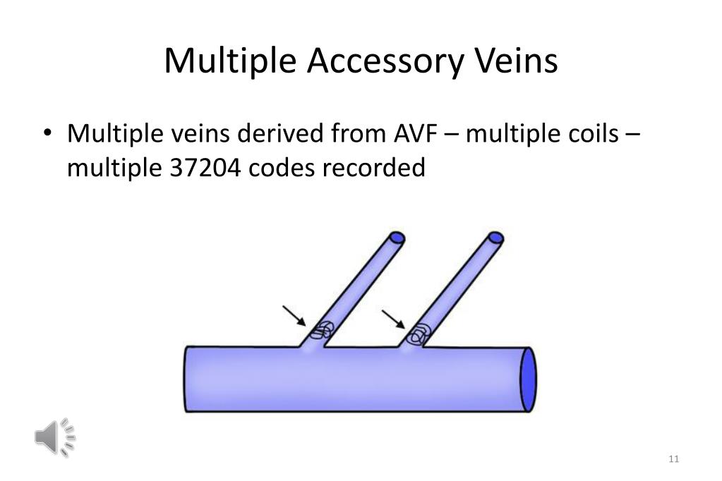 PPT - Treatment of Accessory Vein PowerPoint Presentation, free ...