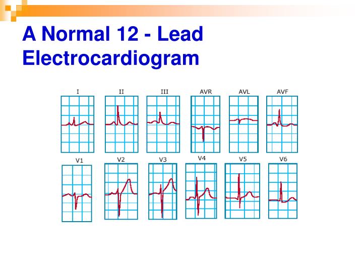 PPT - Ulkumen Rodoplu, MD EuSEM PowerPoint Presentation - ID:3257106