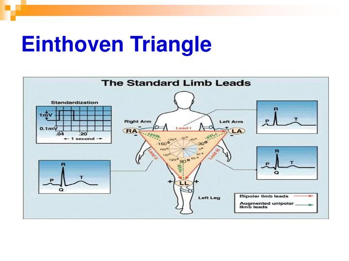 PPT - Ulkumen Rodoplu, MD EuSEM PowerPoint Presentation - ID:3257106