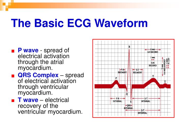 PPT - Ulkumen Rodoplu, MD EuSEM PowerPoint Presentation - ID:3257106