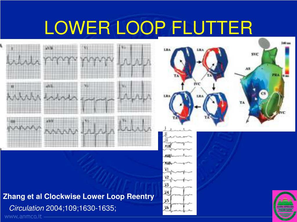 PPT - MINIMASTER DI ELETTROCARDIOGRAFIA PowerPoint Presentation, free download - ID:3257177