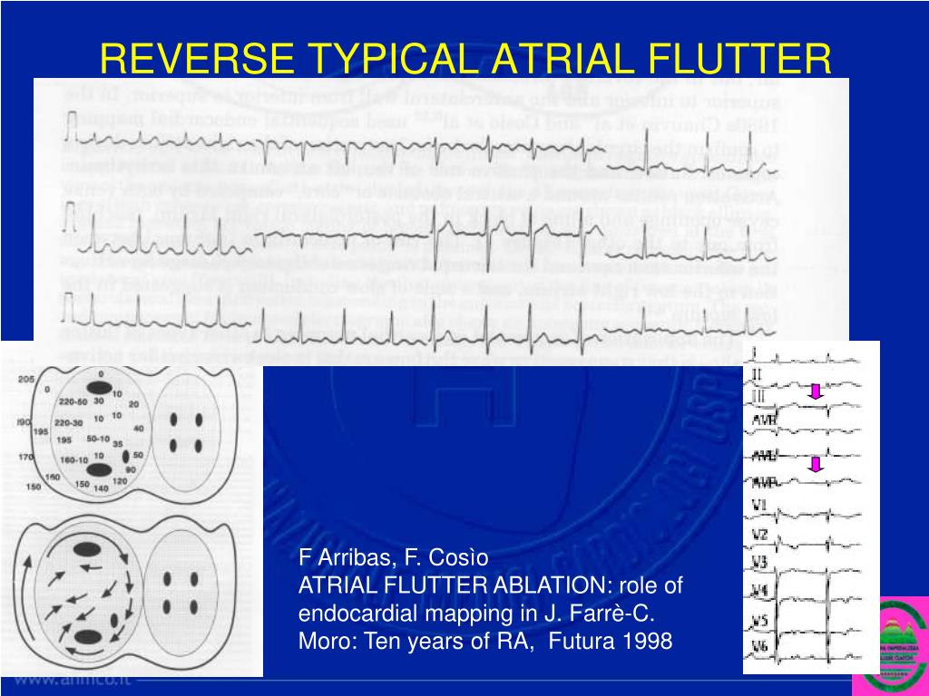 PPT - MINIMASTER DI ELETTROCARDIOGRAFIA PowerPoint Presentation, free download - ID:3257177