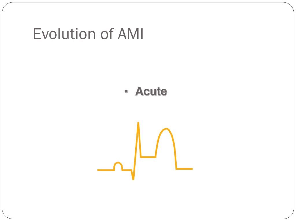 PPT - The 12 Lead ECG in Acute Coronary Syndromes PowerPoint ...