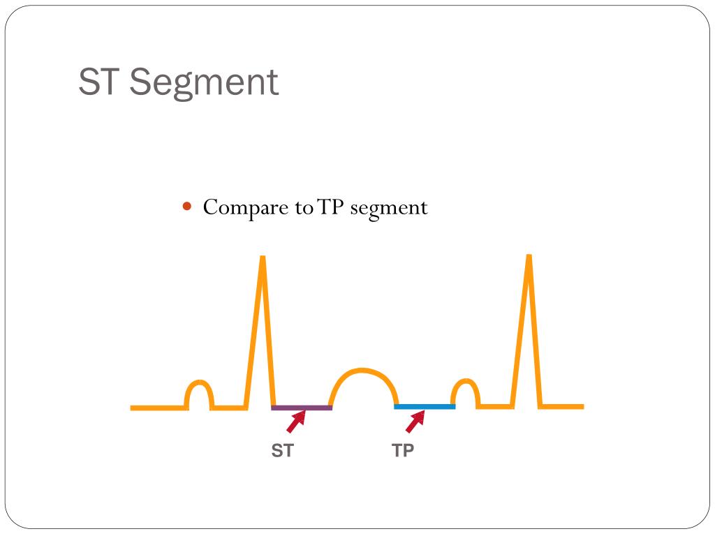 PPT - The 12 Lead ECG in Acute Coronary Syndromes PowerPoint ...