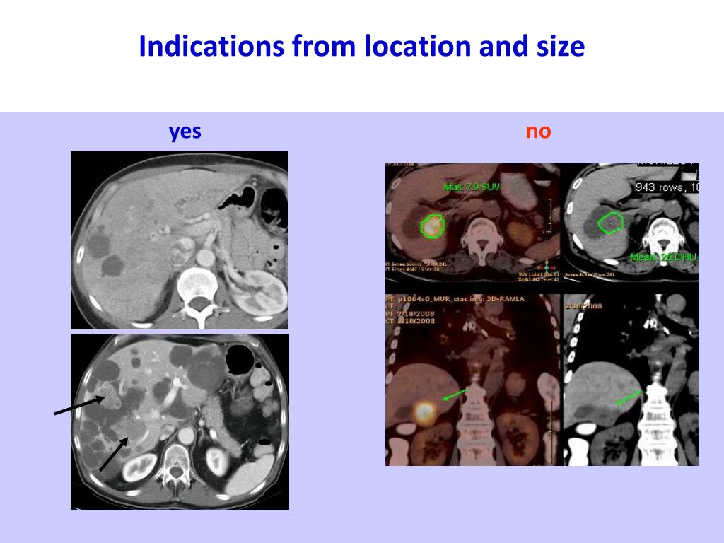 PPT - *Institute of Clinical Radiology and Nuclear Medicine PowerPoint ...