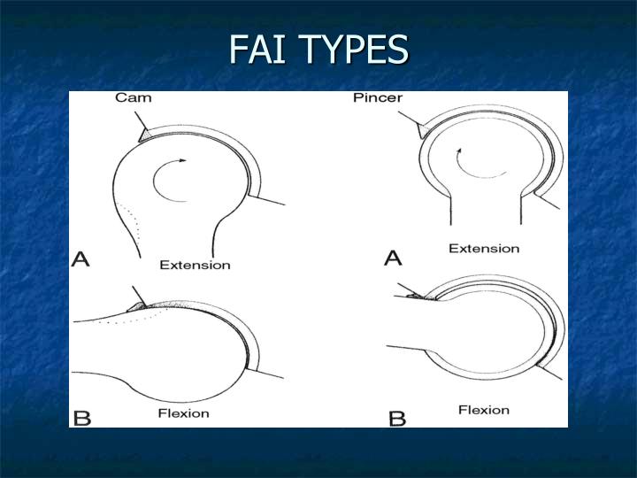 PPT - SURGICAL HIP DISLOCATION PowerPoint Presentation - ID:3258313
