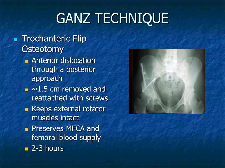 PPT - SURGICAL HIP DISLOCATION PowerPoint Presentation - ID:3258313