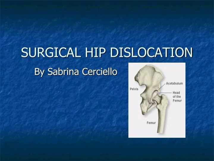 PPT - SURGICAL HIP DISLOCATION PowerPoint Presentation, free download ...