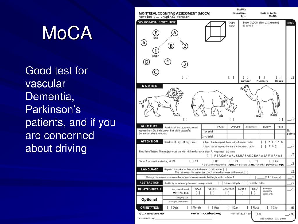 Moca Test Australia Sherymet