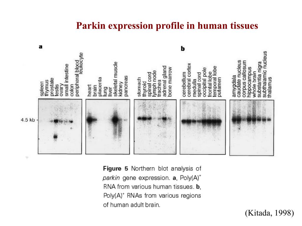 PPT - February 19 th BIOS E108 Parkinson’s disease: Parkin and PINK1 ...