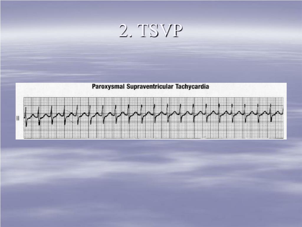PPT - Generalidades Sobre el Diagnóstico y Tratamiento de Alteraciones ...