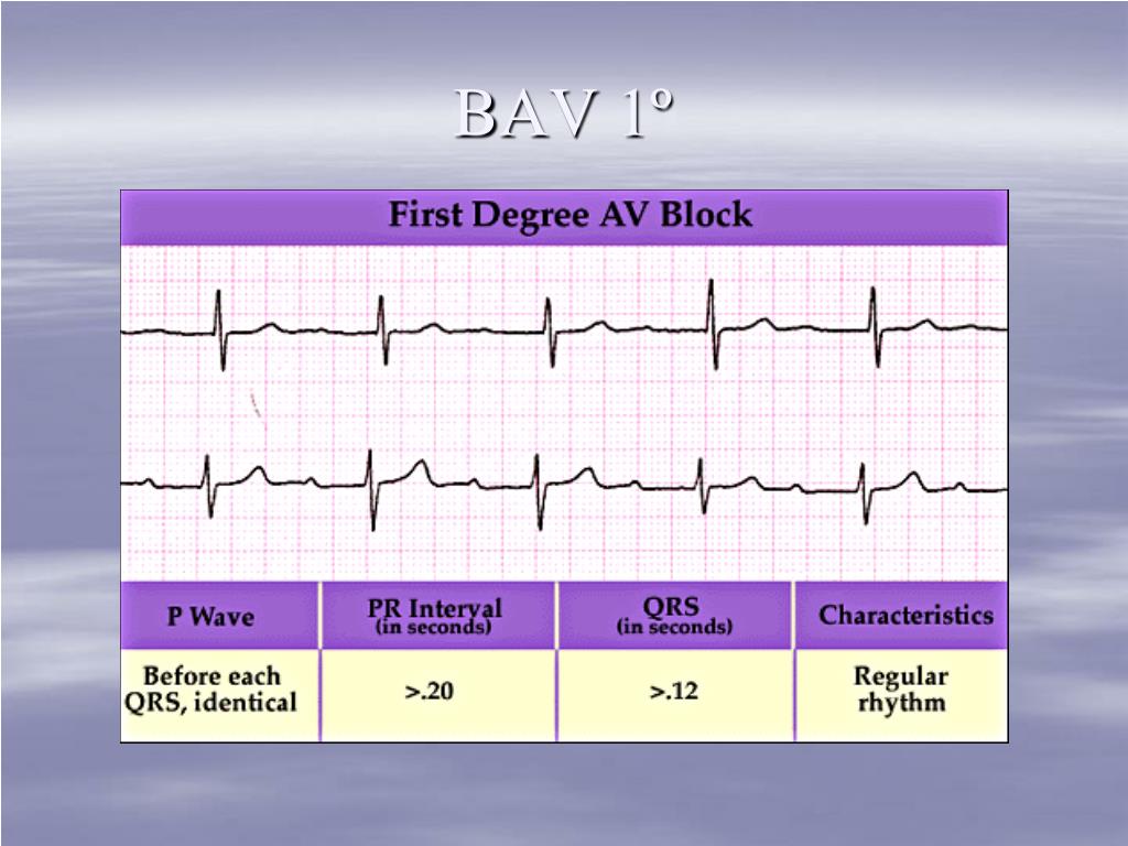 PPT - Generalidades Sobre el Diagnóstico y Tratamiento de Alteraciones ...