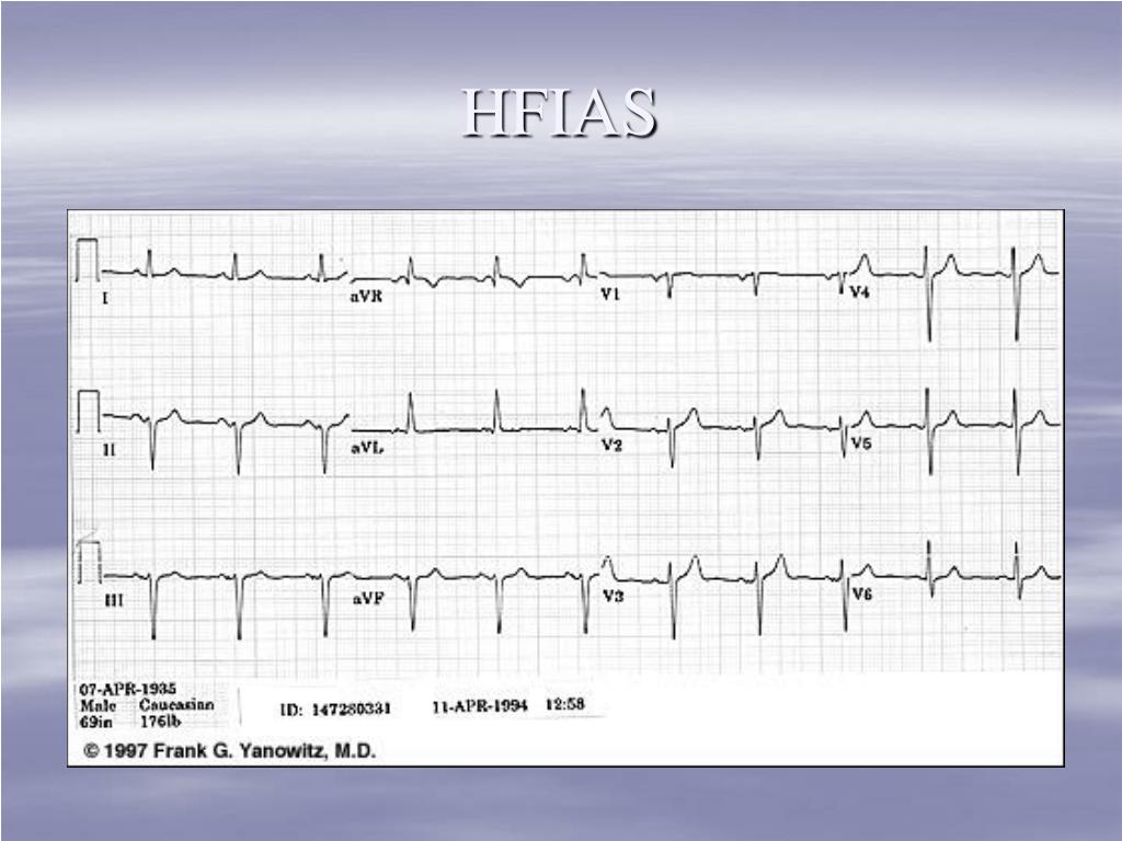 PPT - Generalidades Sobre el Diagnóstico y Tratamiento de Alteraciones ...