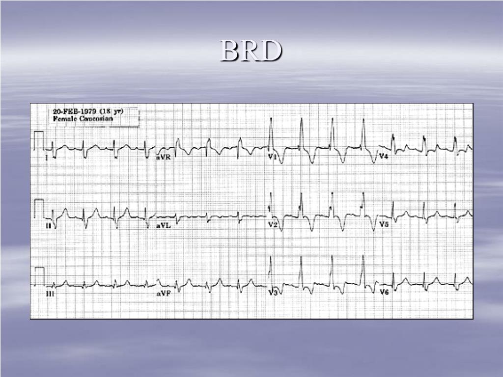 PPT - Generalidades Sobre el Diagnóstico y Tratamiento de Alteraciones ...