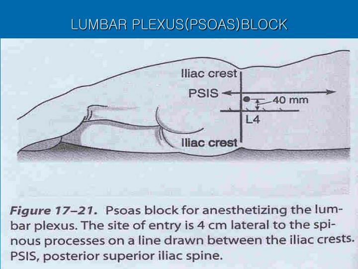 PPT - Peripheral nerve block techniques for ambulatory surgery ...