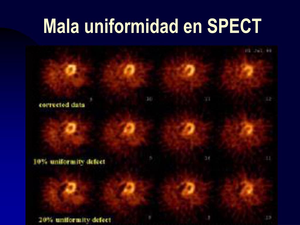PPT - Control de Calidad en Medicina Nuclear PowerPoint Presentation, free download - ID:3264116