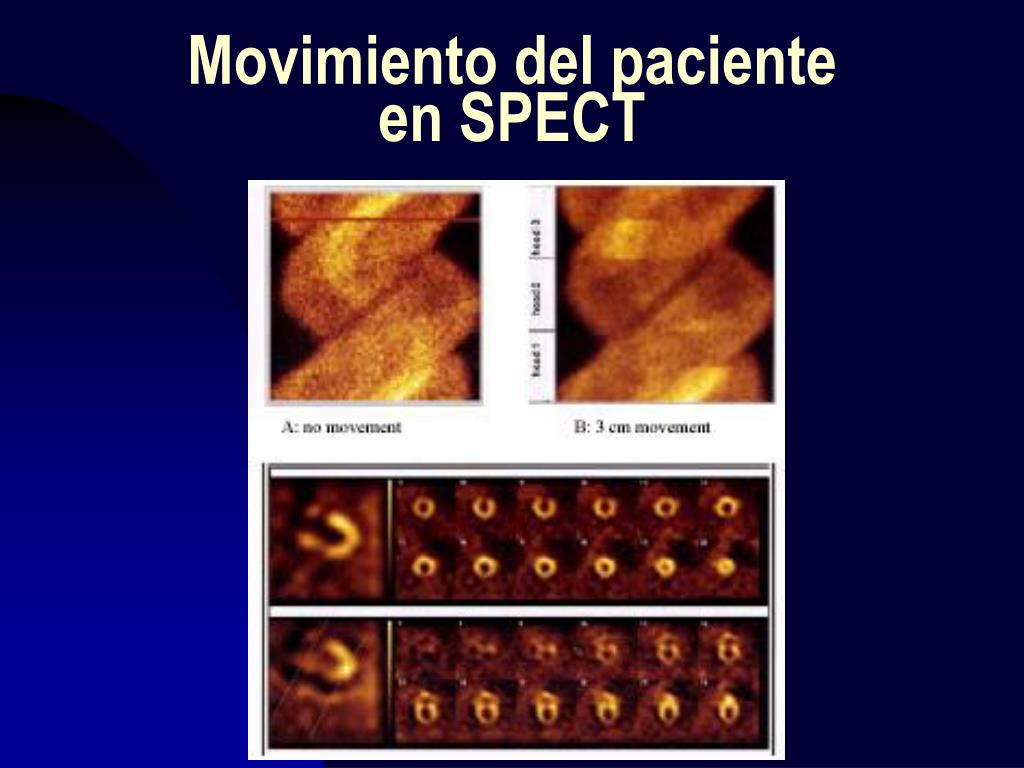 PPT - Control de Calidad en Medicina Nuclear PowerPoint Presentation, free download - ID:3264116