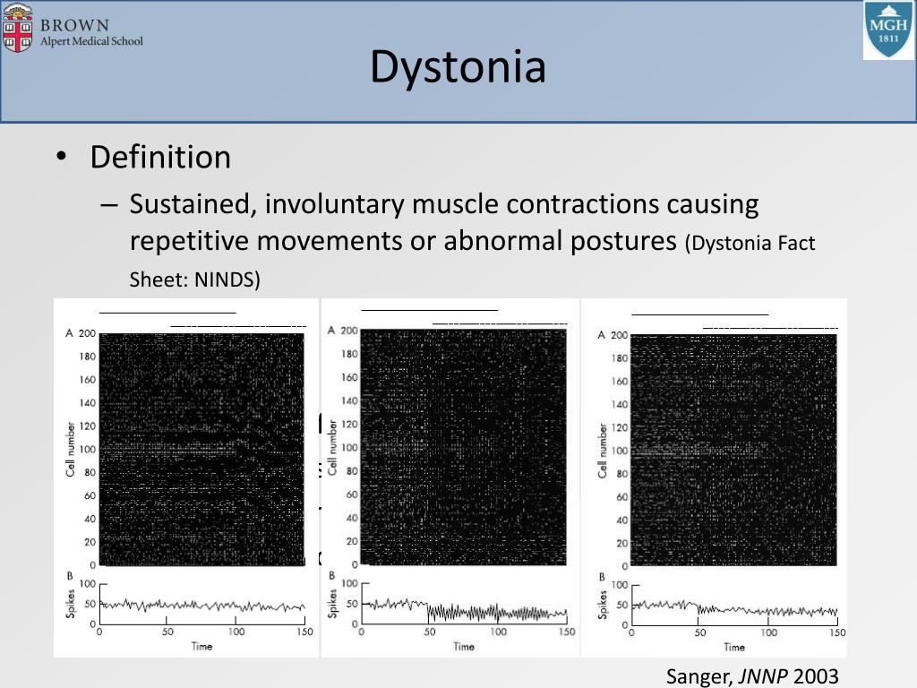 PPT - Neurosurgical Management of Dystonia: The Past, Present, and ...