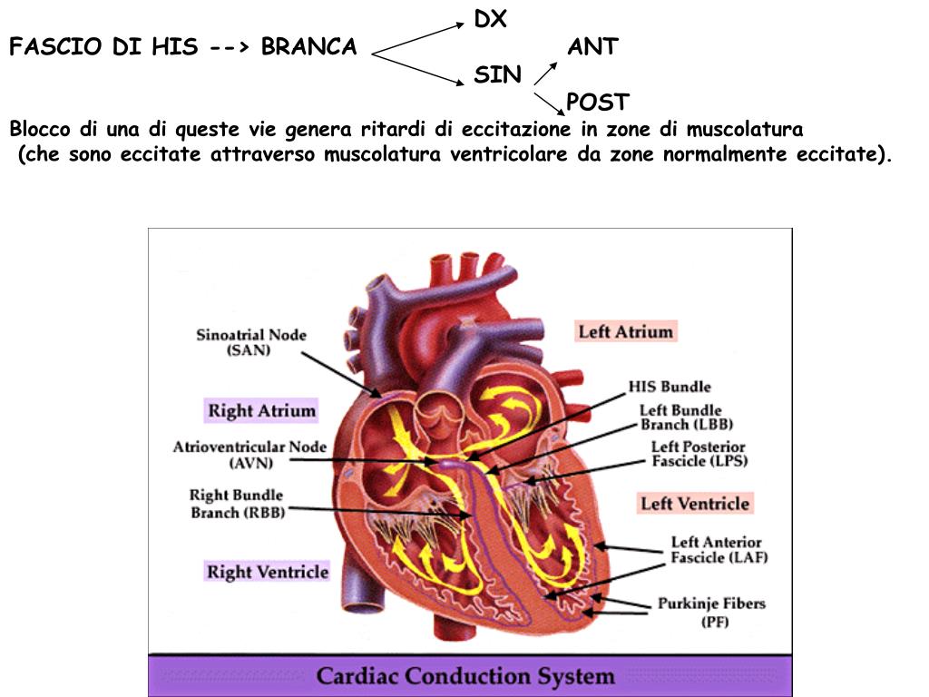 PPT - BLOCCHI ATRIO-VENTRICOLARI (BAV) BAV 1° GRADO (incompleto o ...
