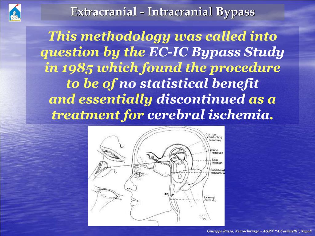 PPT - Rivascolarizzazione Cerebrale Tecnica Chirurgica PowerPoint ...