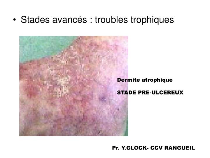 PPT - LA CHIRURGIE des VARICES PowerPoint Presentation - ID:3268295