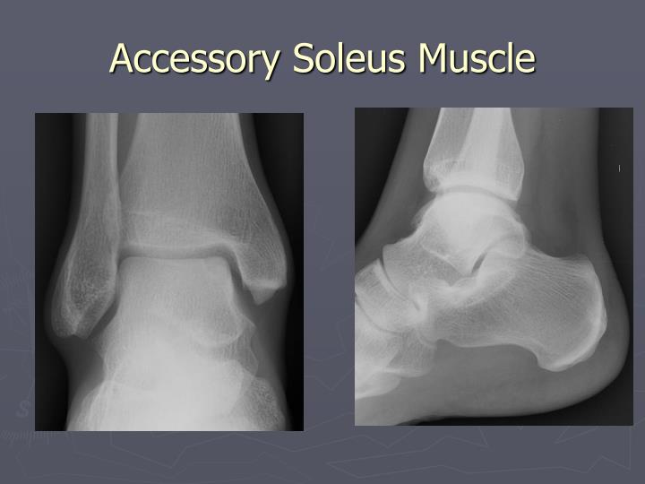 PPT - Musculoskeletal MRI PowerPoint Presentation - ID:3269062