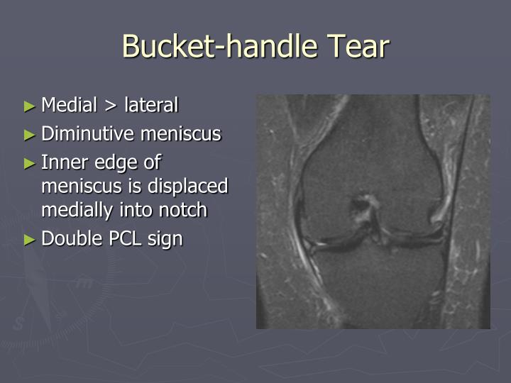 PPT - Musculoskeletal MRI PowerPoint Presentation - ID:3269062