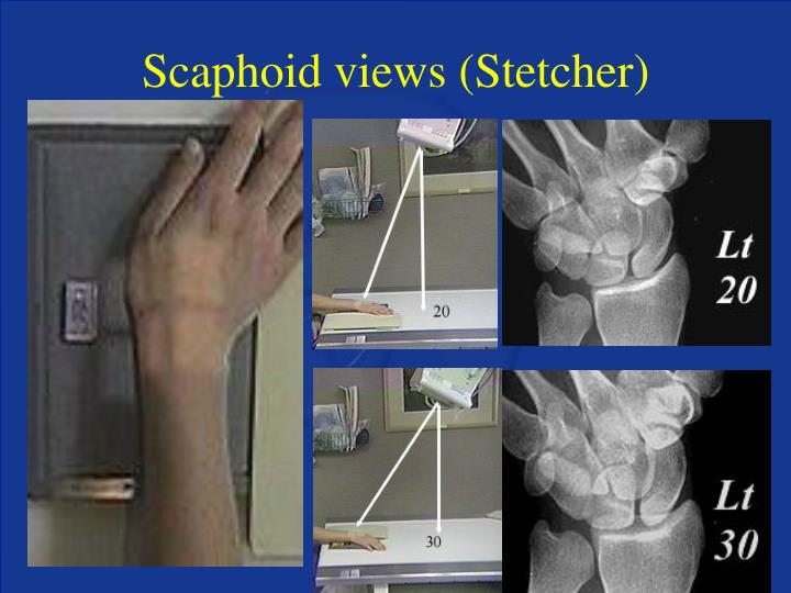 PPT - Radiographic Anatomy and Positioning of the Upper Extremity ...